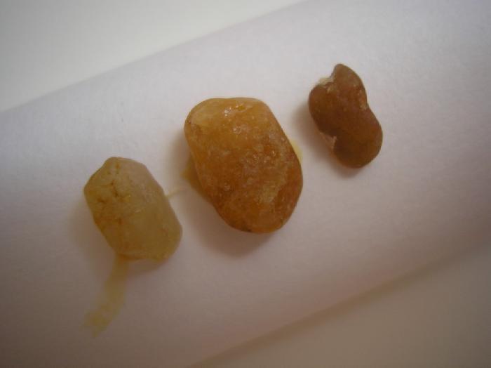 Cymophane: Mineral information, data and localities.